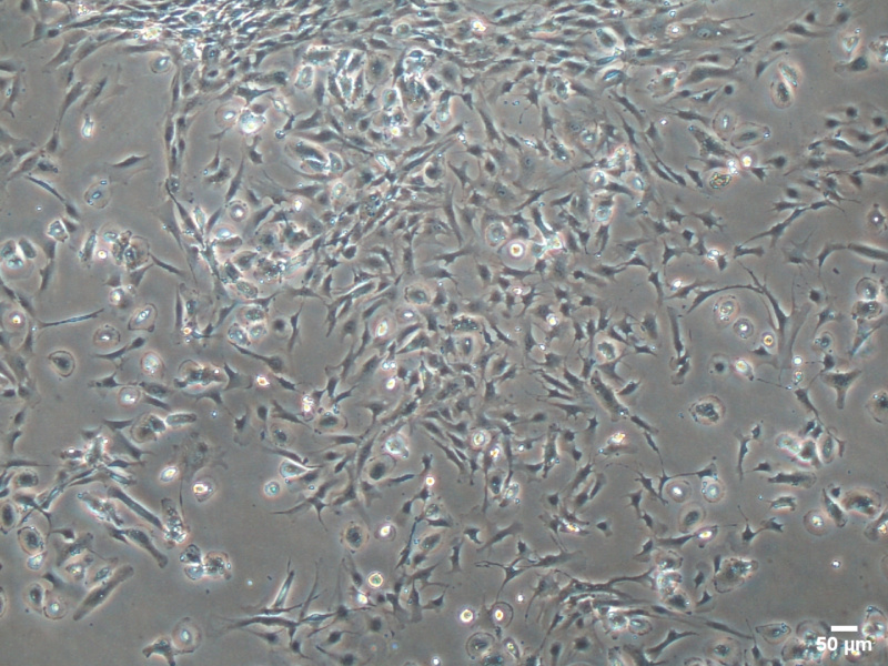 Human Hepatic Stellate Cells | BeCytes Biotechnologies