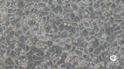 Primary human hepatocytes vs. cell lines in research
